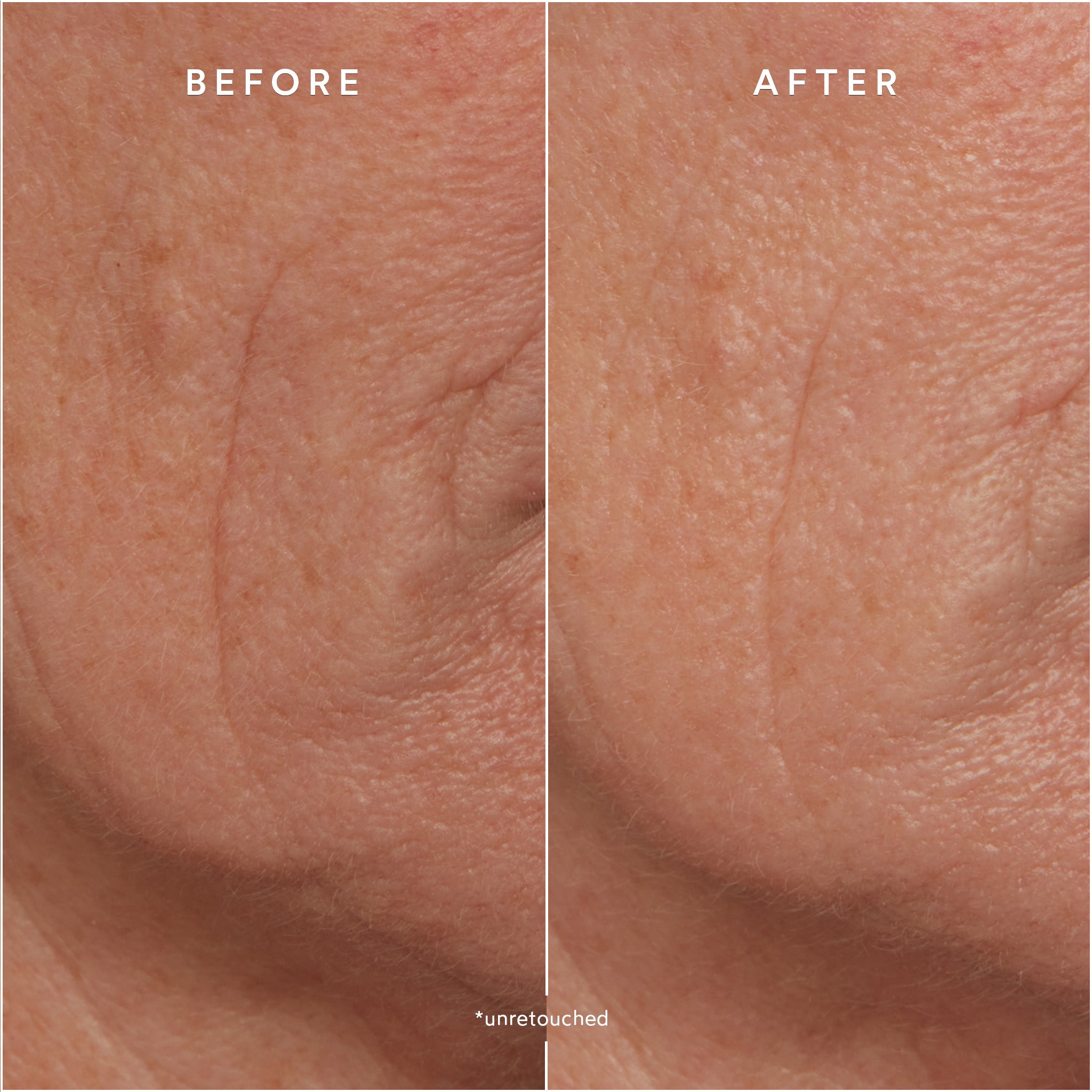 True Botanicals SuperSEA Firming & Lifting Treatment | The Detox Market ...